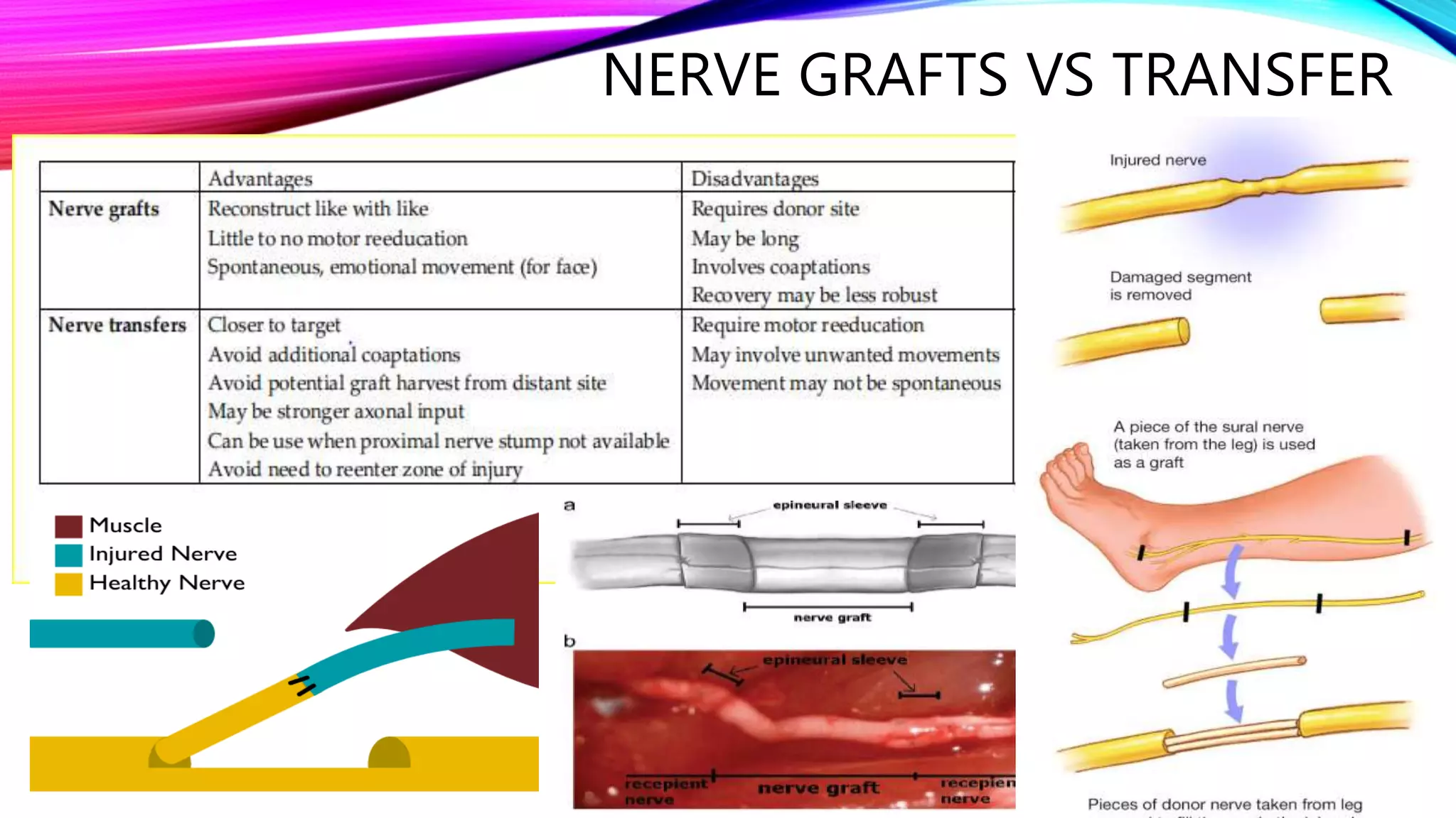 Principles and applications of Nerve transfer by Maheen Fatima.pptx