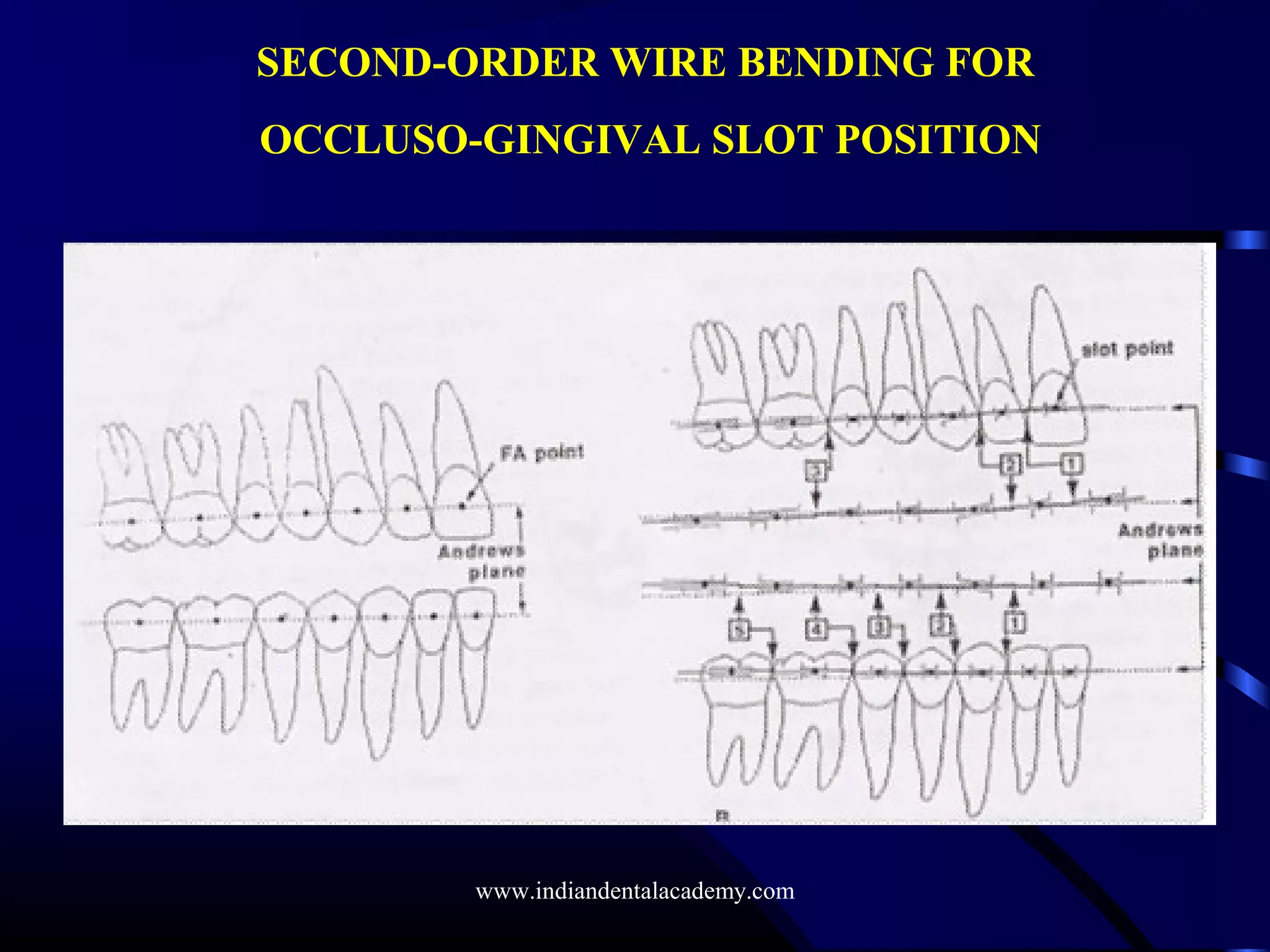 Principles and concept of andrew’s preadjusted edgewise appliance ...