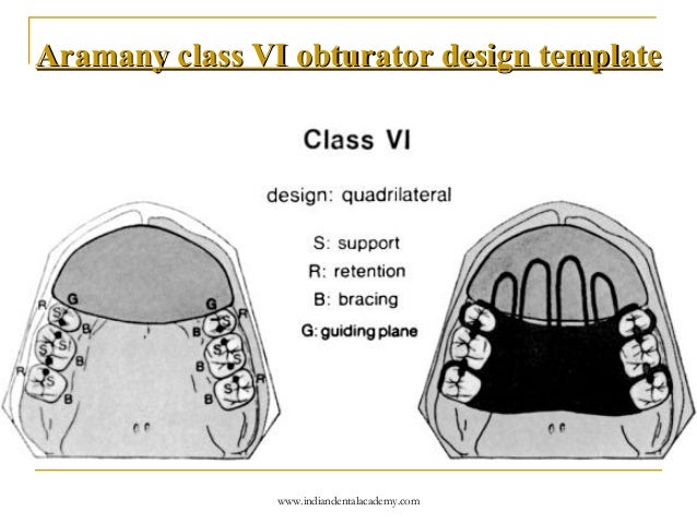 Principles and concepts of designing obturators/ orthodontic seminars