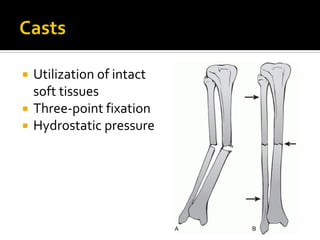 Principles and conservative treatment of fractures.2560