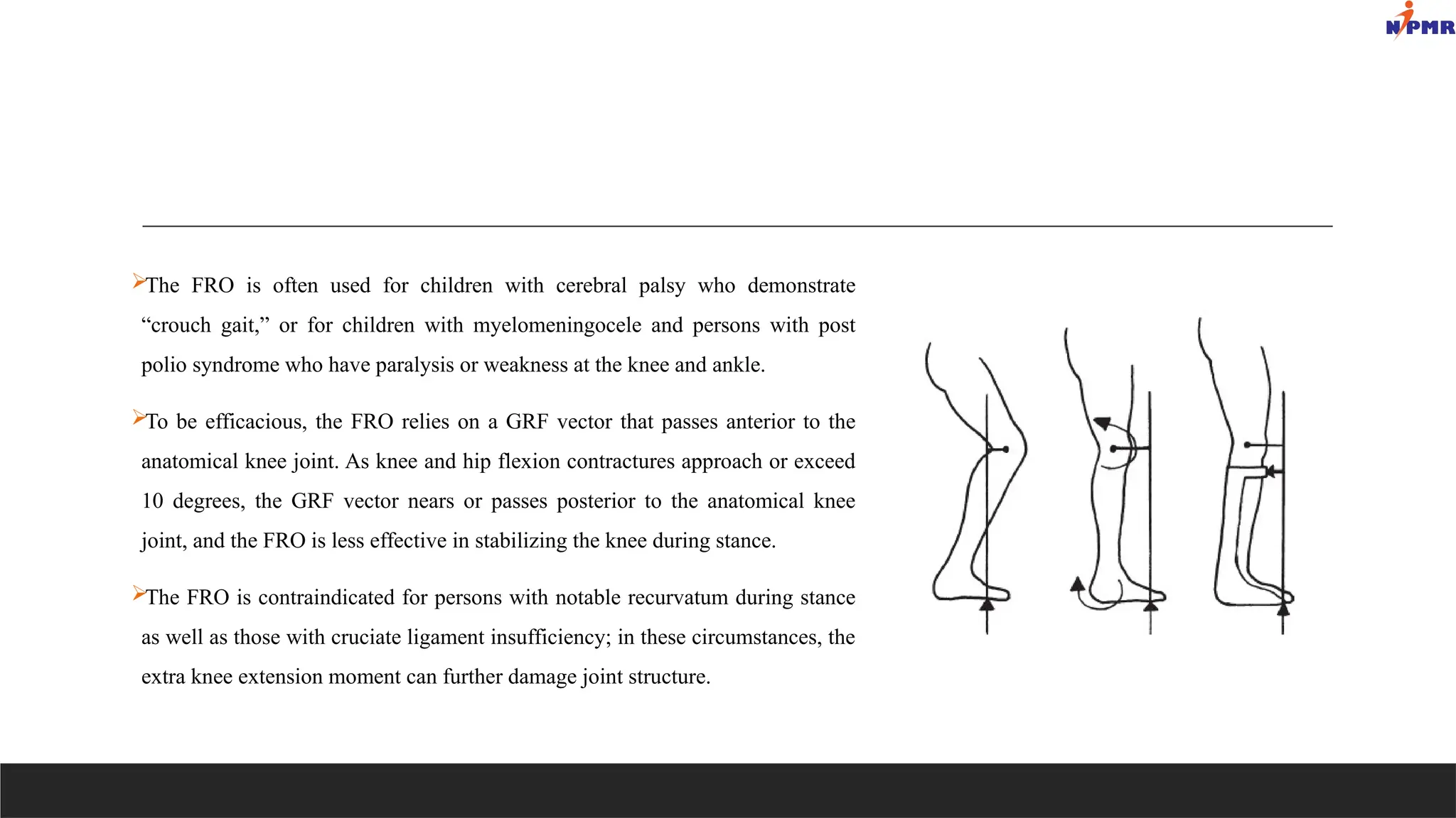 PRINCIPLES AND DESIGN OF LOWER EXTRIMITY PROSTHESIS.pptx