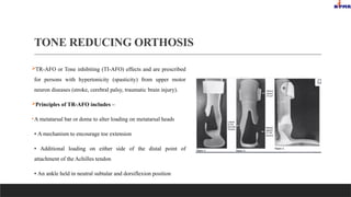 PRINCIPLES AND DESIGN OF LOWER EXTRIMITY PROSTHESIS.pptx