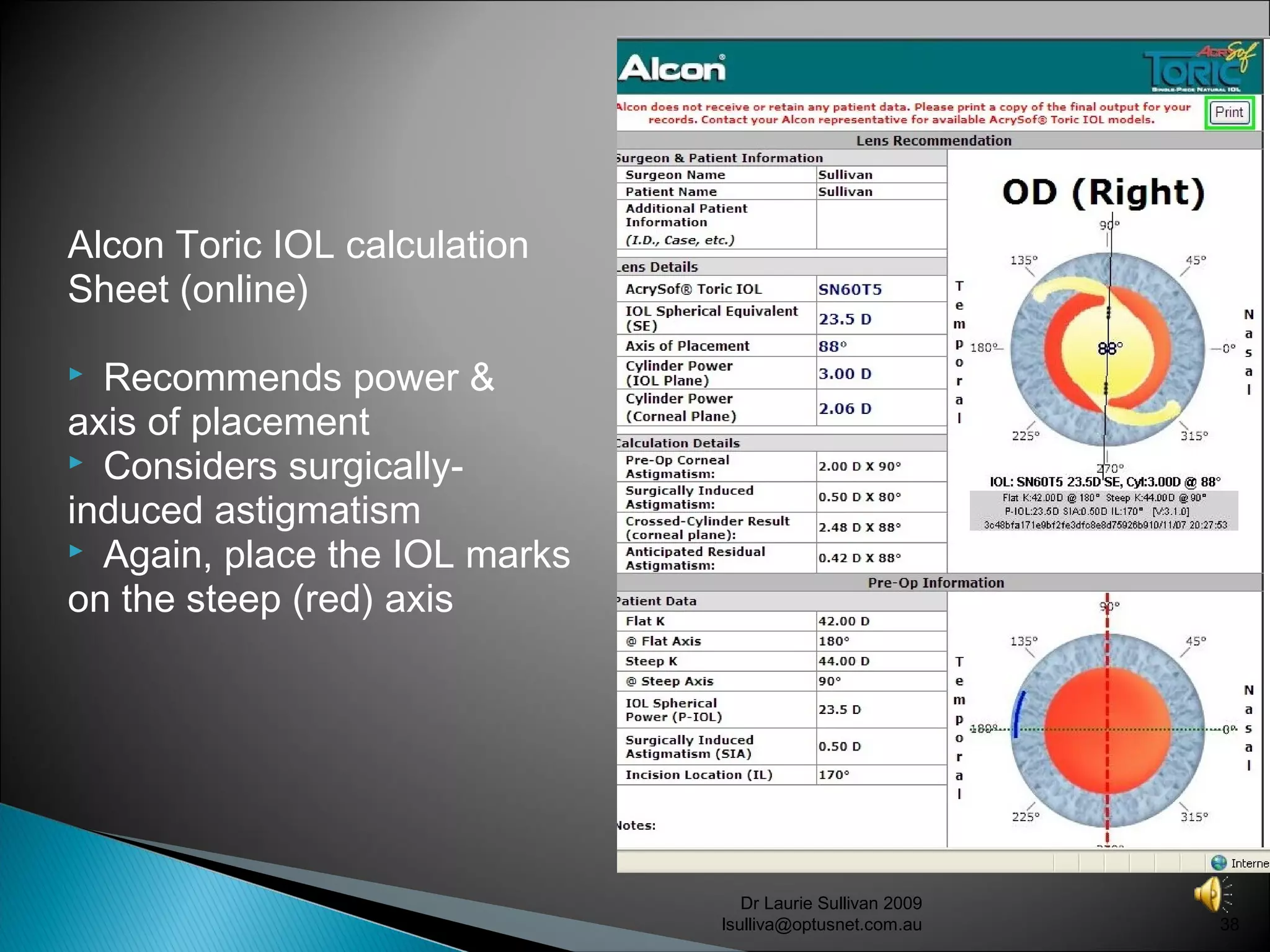 Principles and practice of corneal astigmatic surgery | PPT