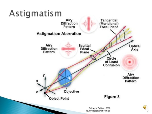 Principles and practice of corneal astigmatic surgery | PPT | Eye and ...