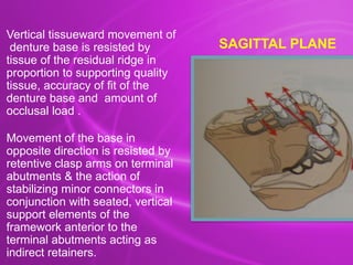 Principles & Designing of Removable partial denture.pptx
