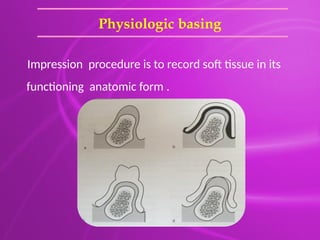 Principles & Designing of Removable partial denture.pptx