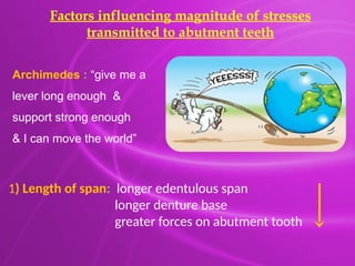 Principles & Designing of Removable partial denture.pptx