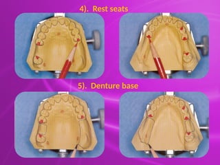 Principles & Designing of Removable partial denture.pptx