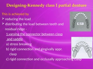 Principles & Designing of Removable partial denture.pptx