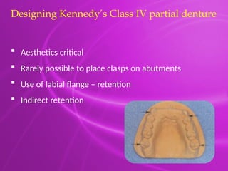 Principles & Designing of Removable partial denture.pptx