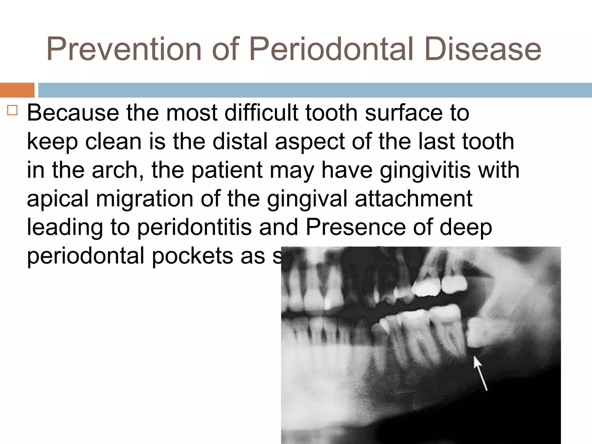 Principles, indications and contraindications of removal of | PPT