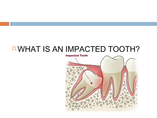 Principles, indications and contraindications of removal of | PPT ...