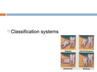 Principles, indications and contraindications of removal of | PPT