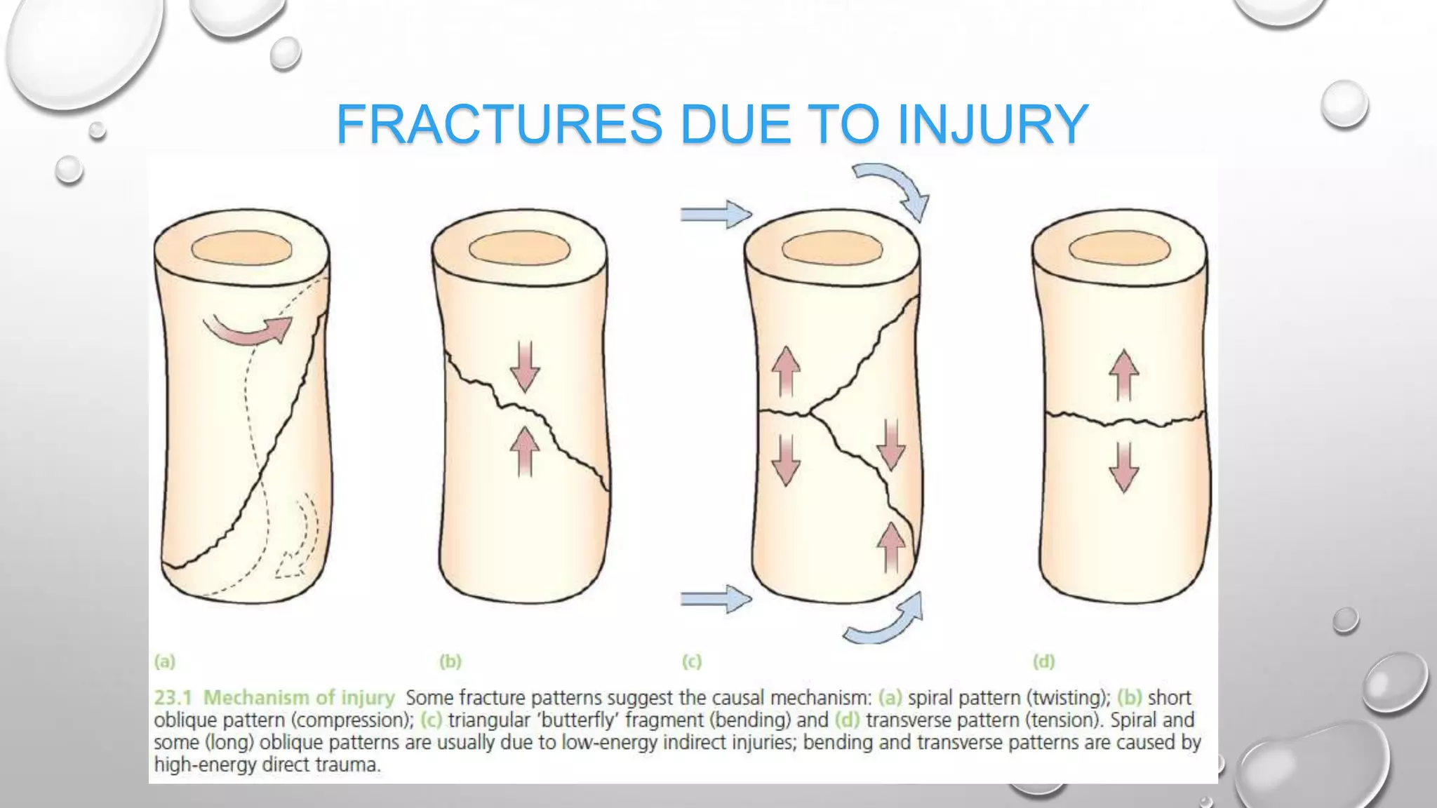 principlesinfracturesmanagement-131009203955-phpapp02.pdf