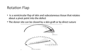Principles In Plastic Surgery including skin grafting , flaps , wound ...