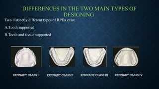 Principles in RPD Design and its importance in surveying | PPTX