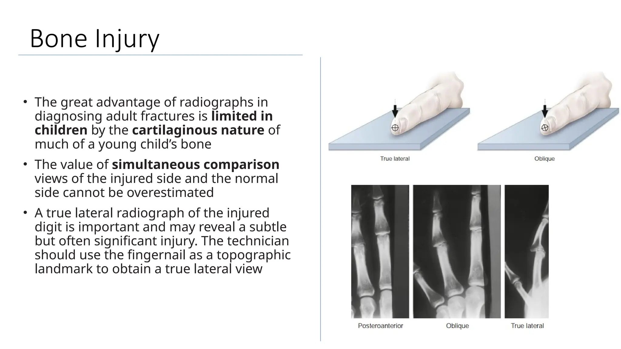 Principles of Acute Care of Hand injuries.pptx