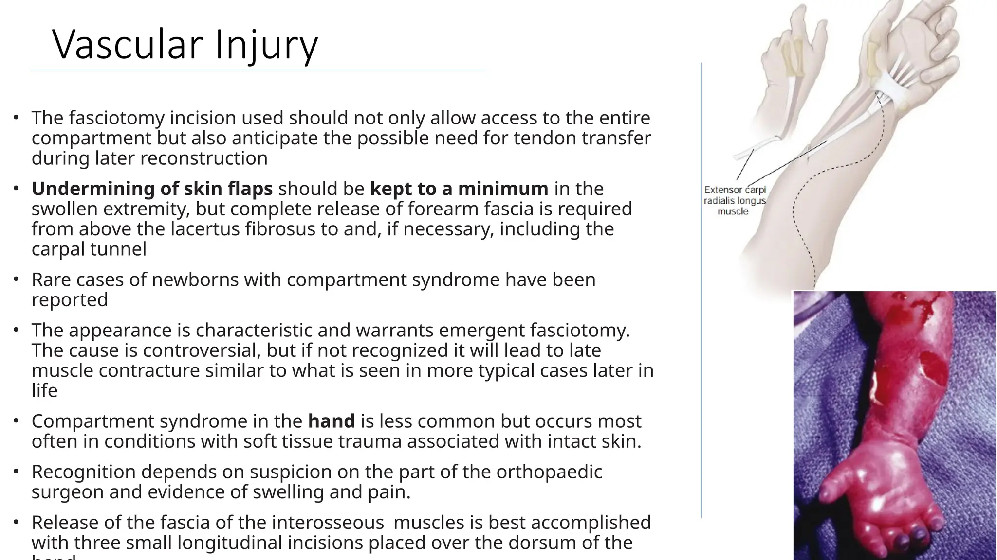Principles of Acute Care of Hand injuries.pptx