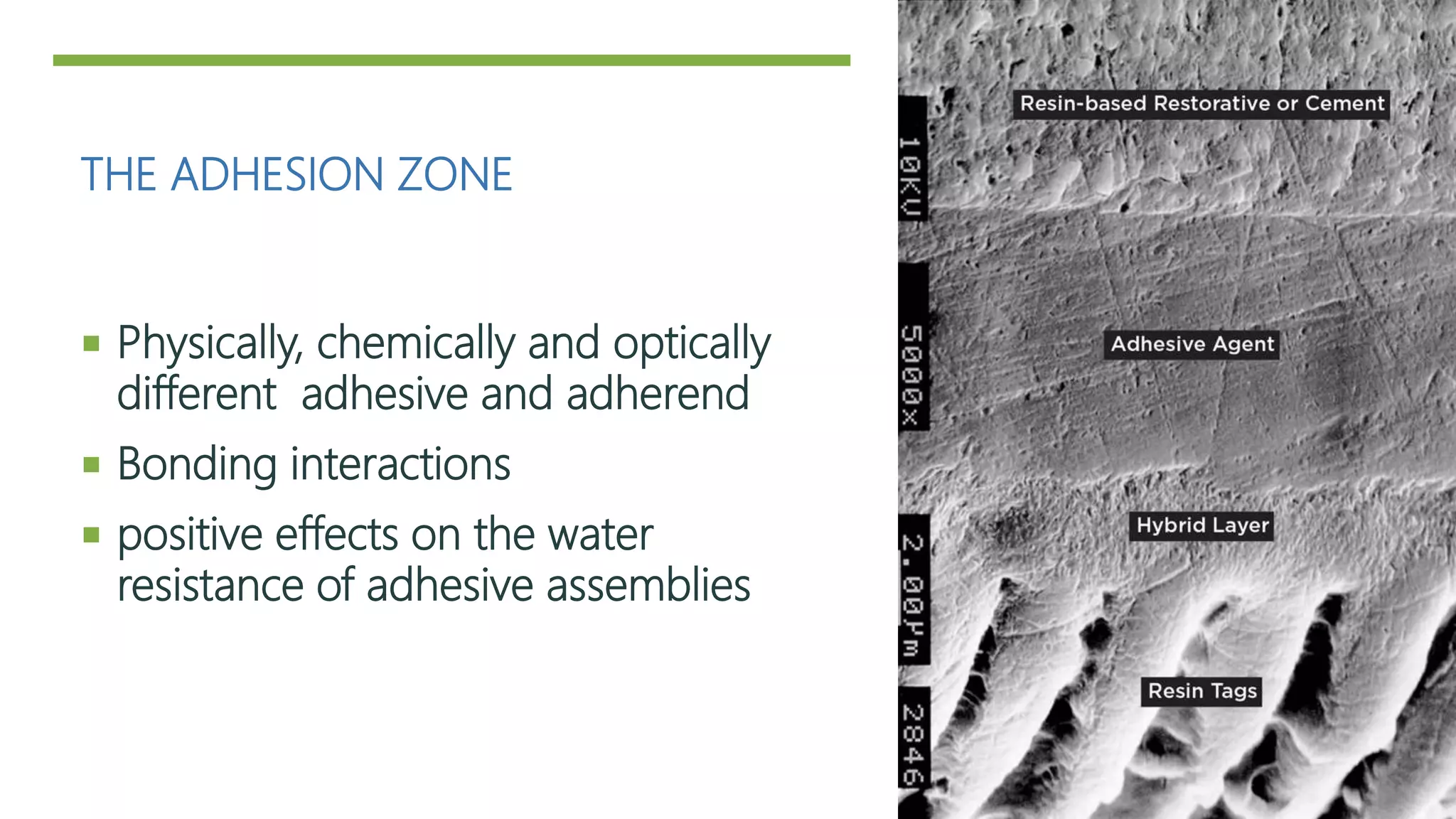 Principles of adhesion in dentistry | PPTX