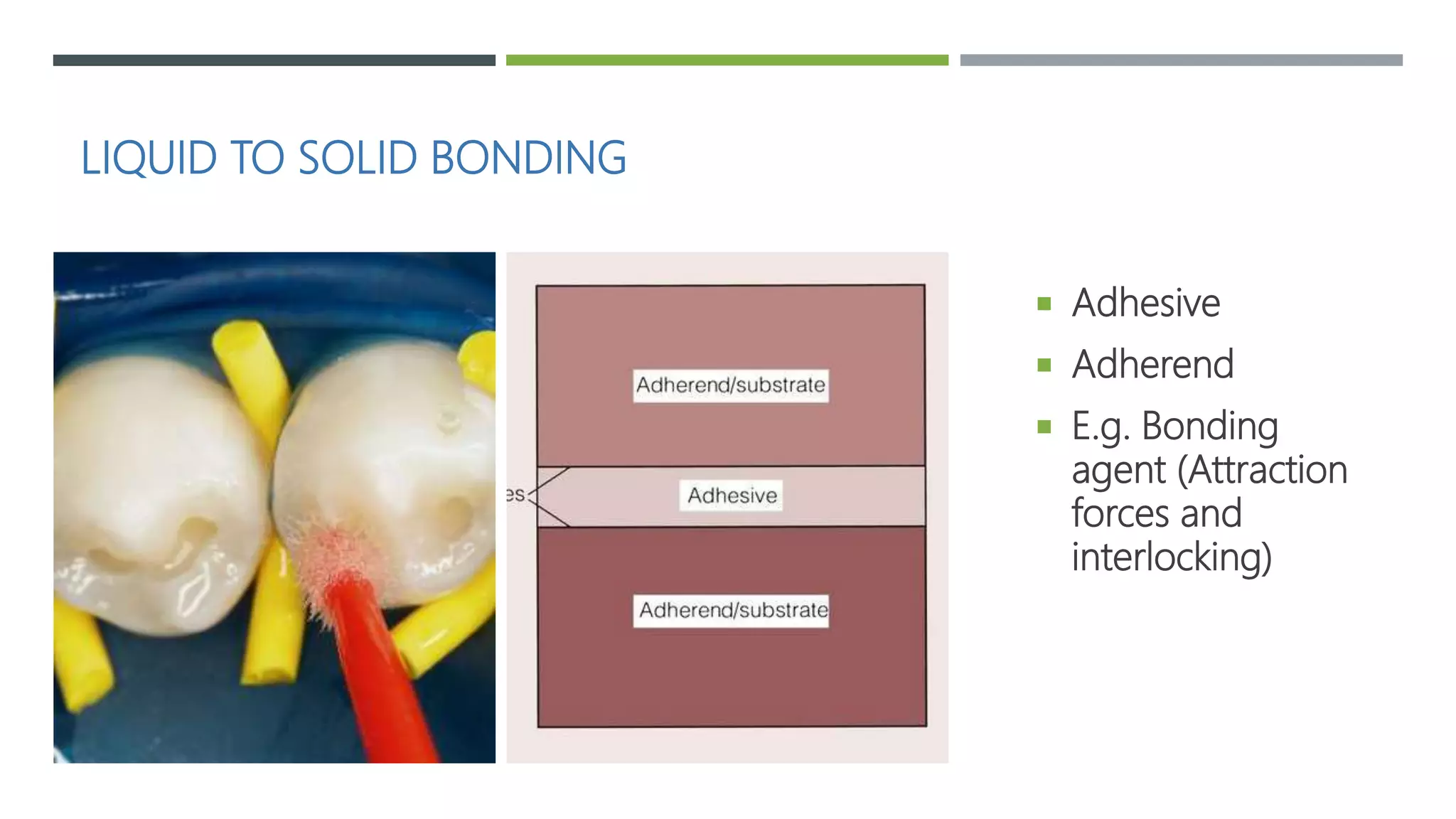 Principles of adhesion in dentistry | PPTX