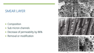 Principles of adhesion in dentistry | PPTX