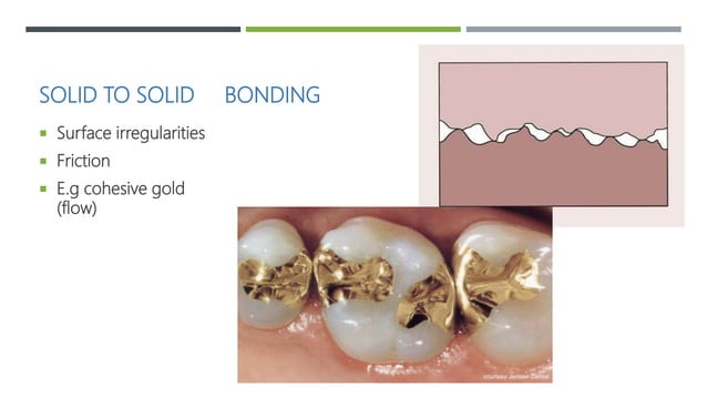 Principles of adhesion in dentistry | PPTX