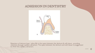 PRINCIPLES OF ADHESION - dental material | PDF