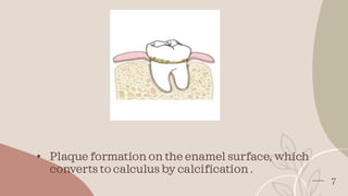 PRINCIPLES OF ADHESION - dental material | PDF