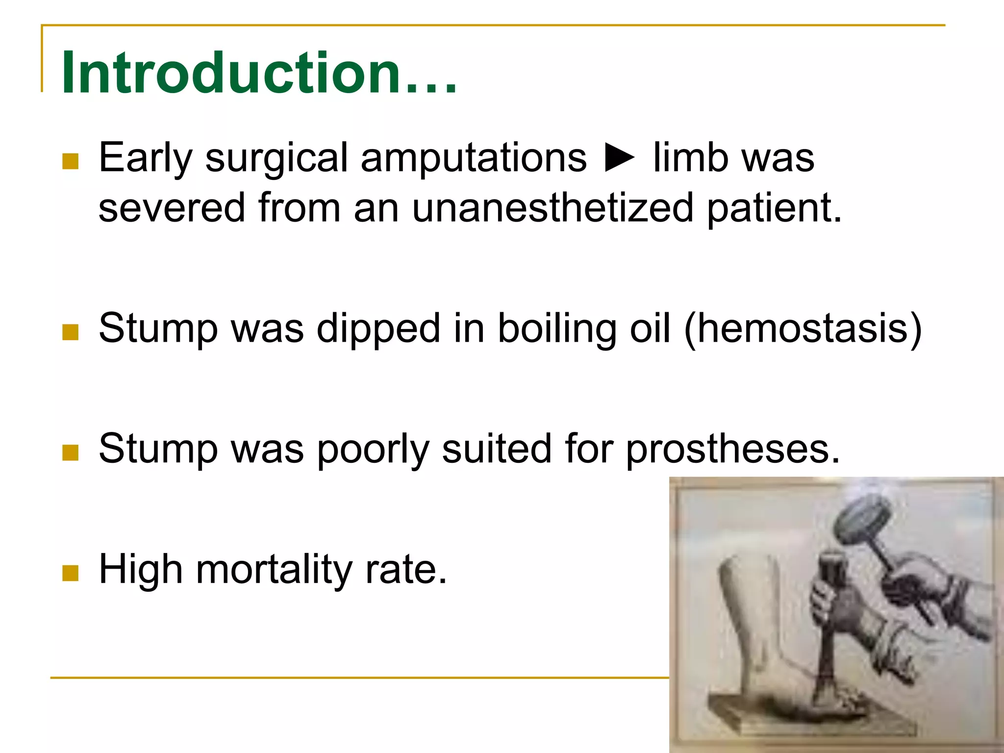 Principles of amputation | PPTX