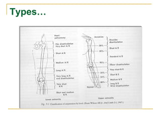 Principles of amputation | PPTX