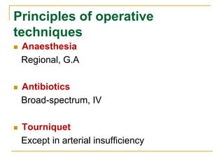 Principles of amputation | PPTX