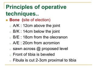 Principles of amputation | PPTX