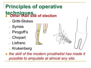 Principles of amputation | PPTX