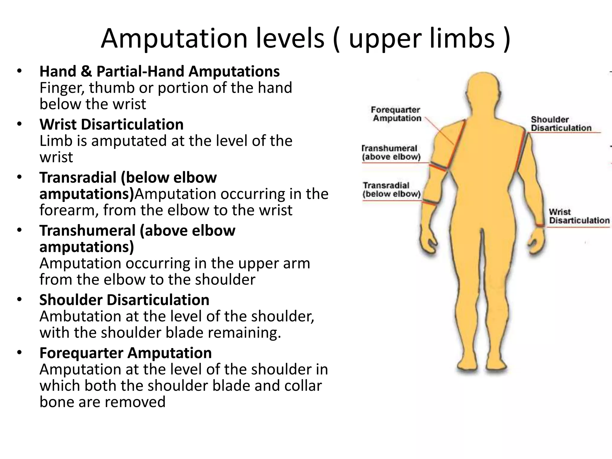 Principles of amputation | PPTX