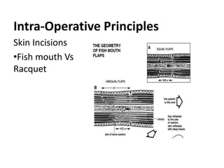 Principles of amputation | PPTX