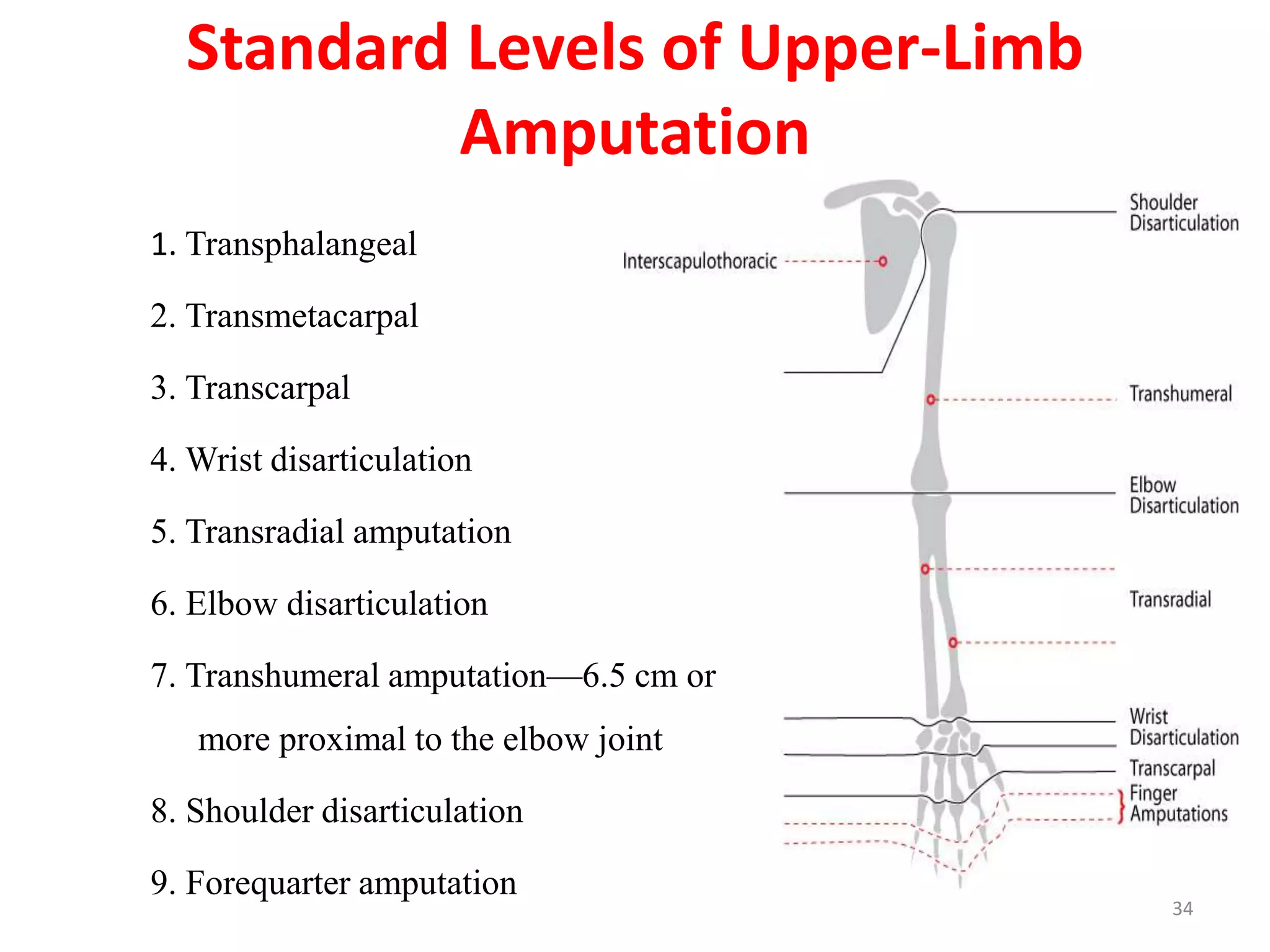Principles Of Amputation | PPTX