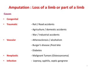 Principles Of Amputation | PPTX