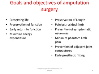 Principles Of Amputation | PPTX