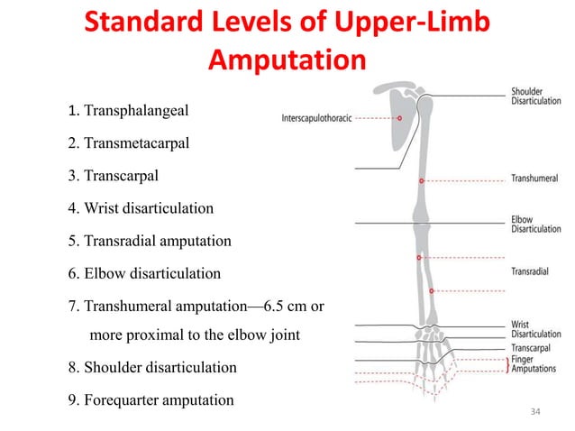 Principles Of Amputation
