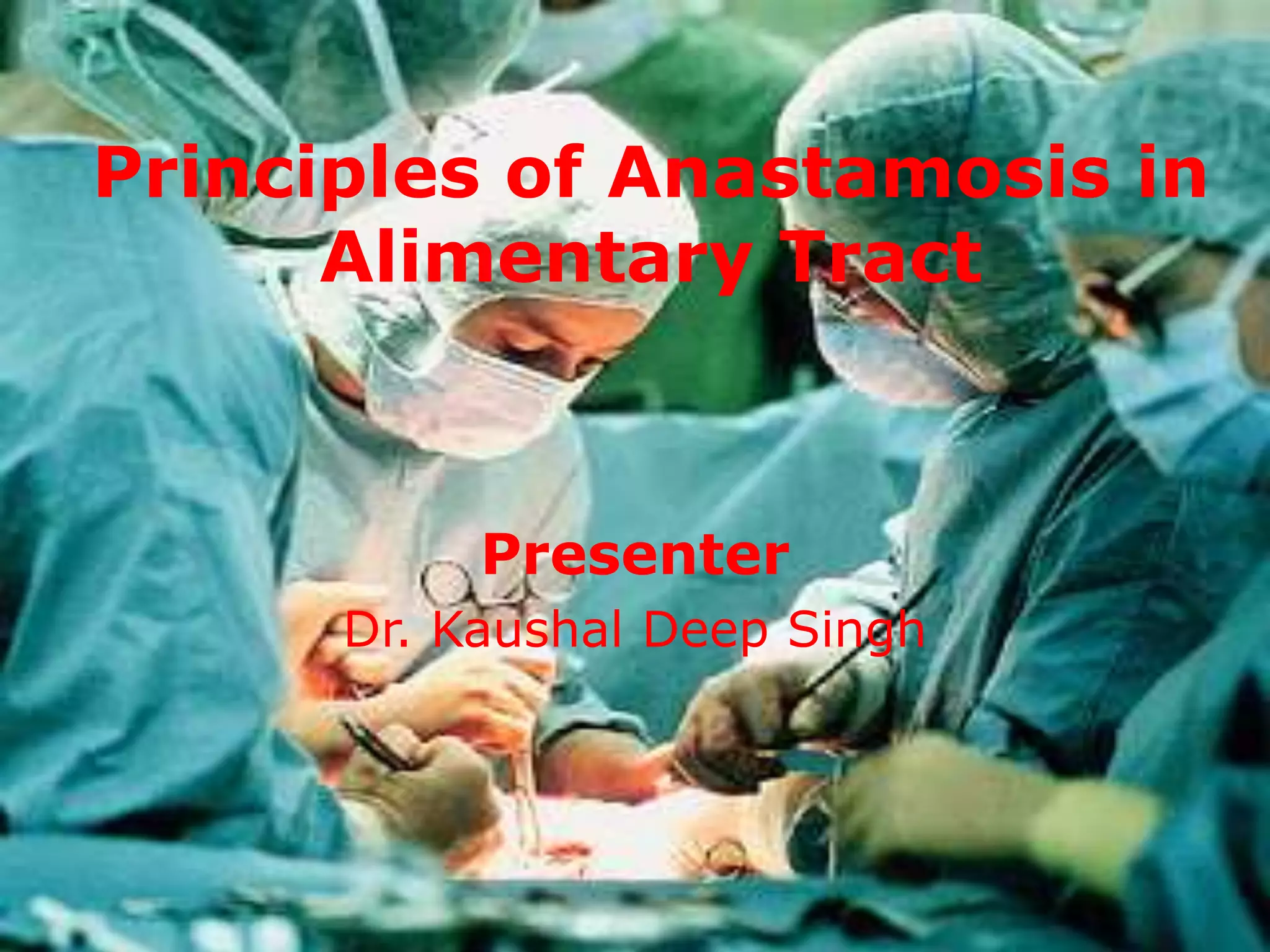 Principles of anastamosis in alimentary tract | PPTX
