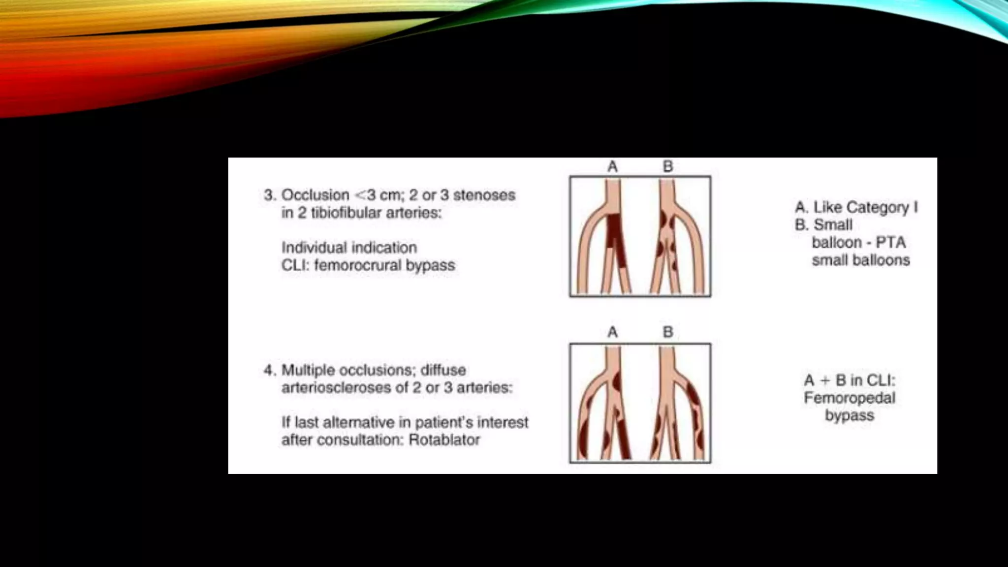Peripheral Angioplasty / Endovascular Management of PVD - Principles | PPTX