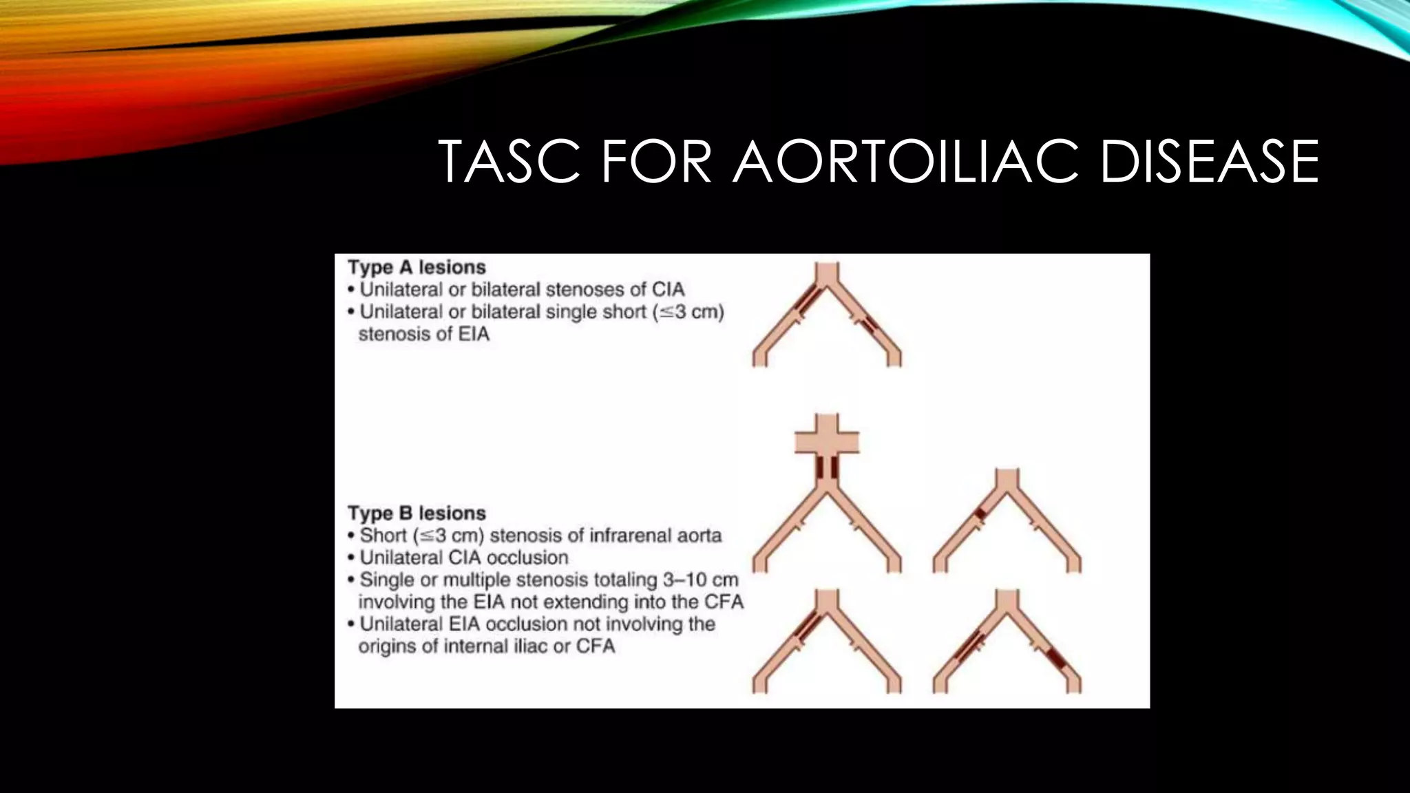 Peripheral Angioplasty / Endovascular Management of PVD - Principles | PPTX