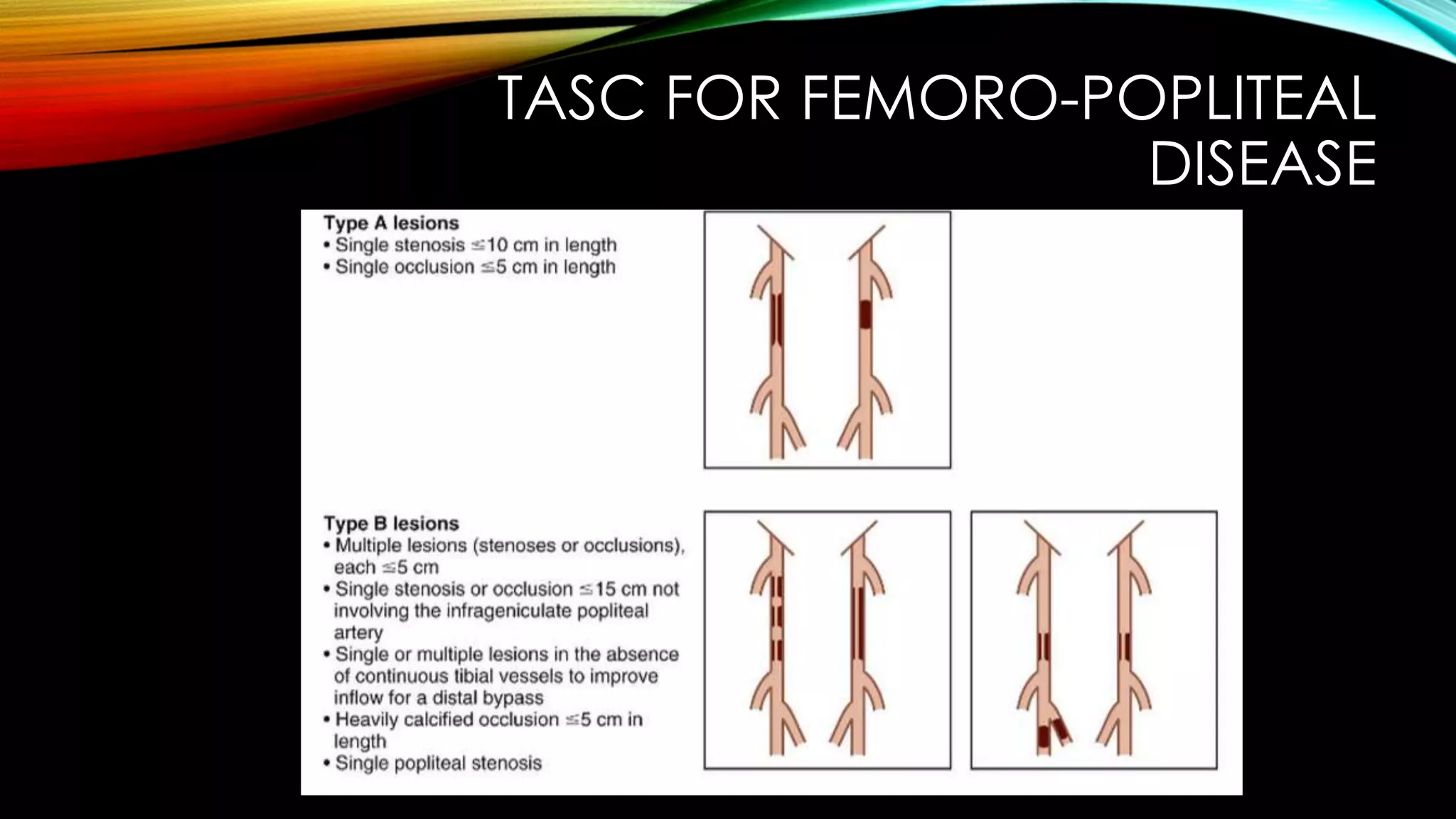Principles of angioplasty -Endovascular Management of Peripheral ...