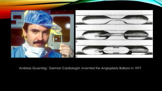 Principles of angioplasty -Endovascular Management of Peripheral ...