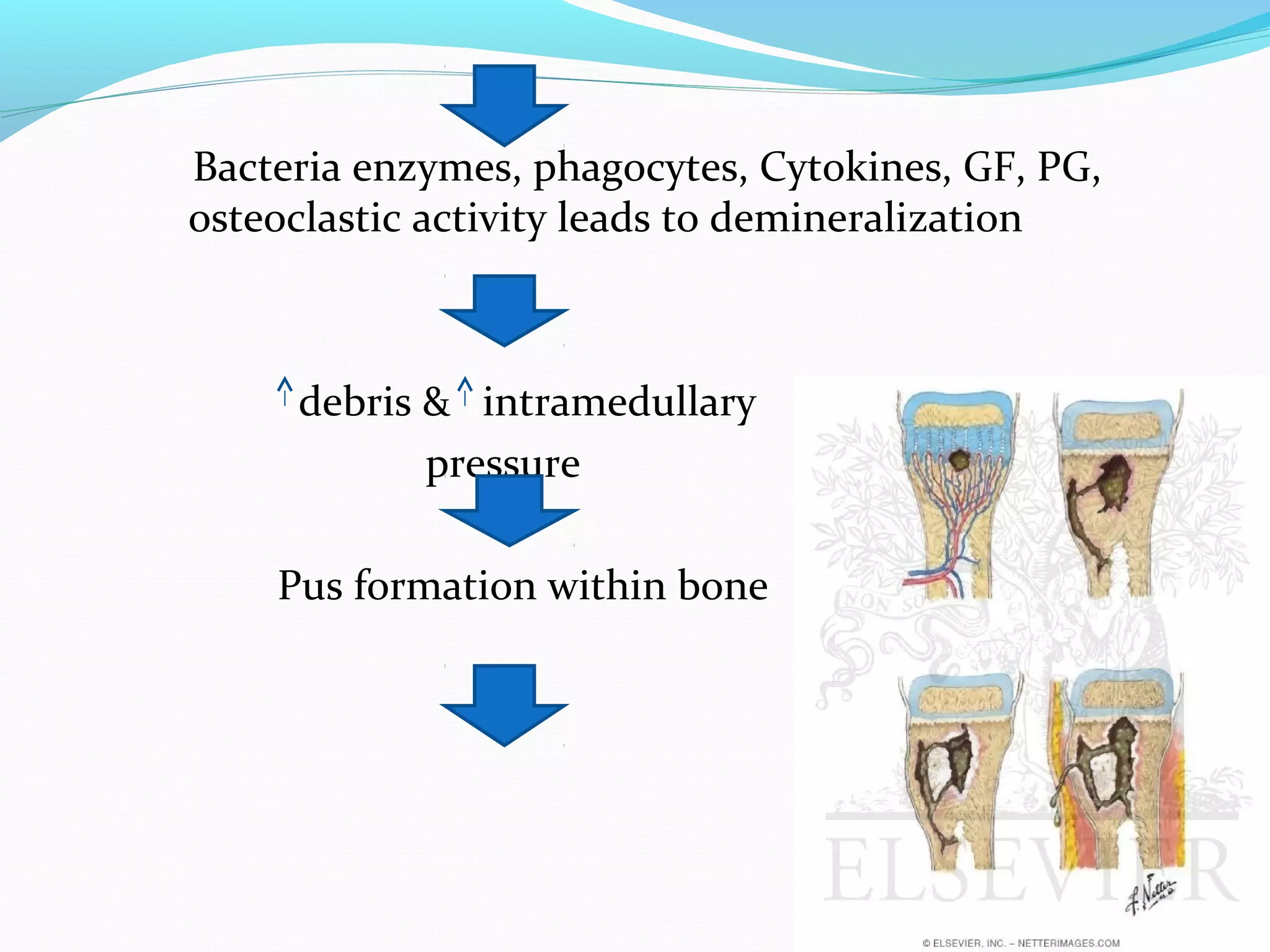 Principles of antibiotic use in management of osteomyelitis | PPT