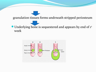 Principles of antibiotic use in management of osteomyelitis | PPT