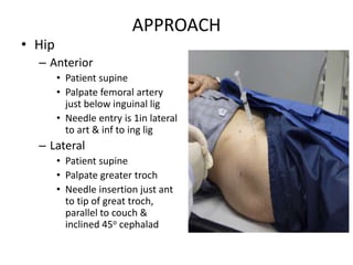 Principles of arthrotomy & arthrocentesis | PPTX
