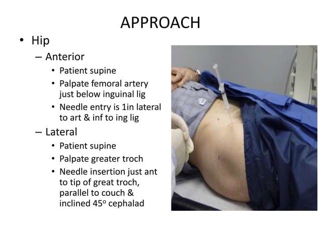 Principles of arthrotomy & arthrocentesis | PPTX