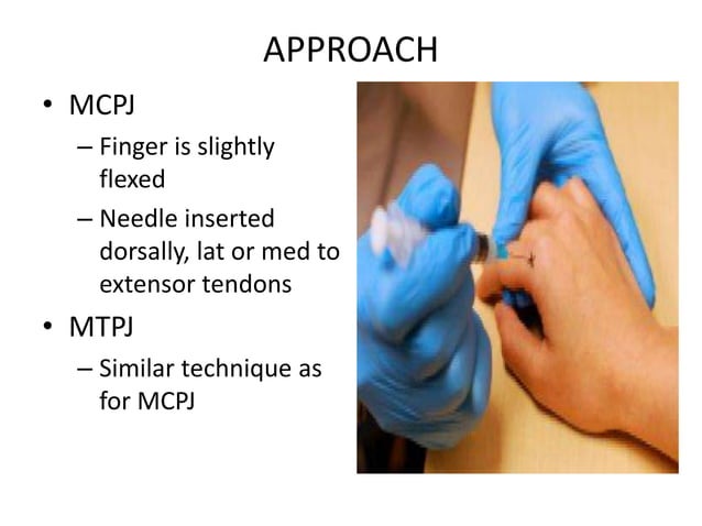 Principles of arthrotomy & arthrocentesis | PPTX