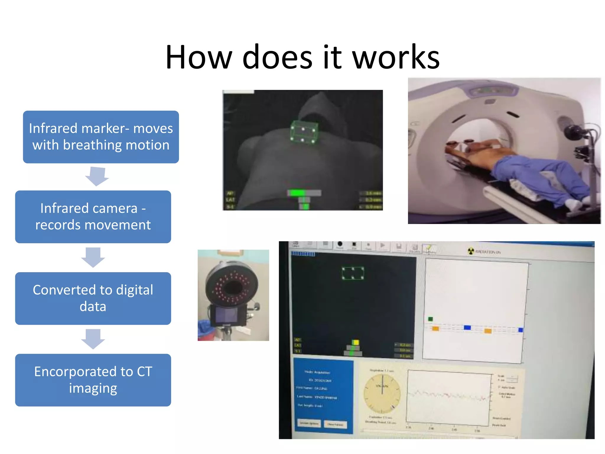 Principles Of Beam Direction And Use Of Simulators Pptx Physics